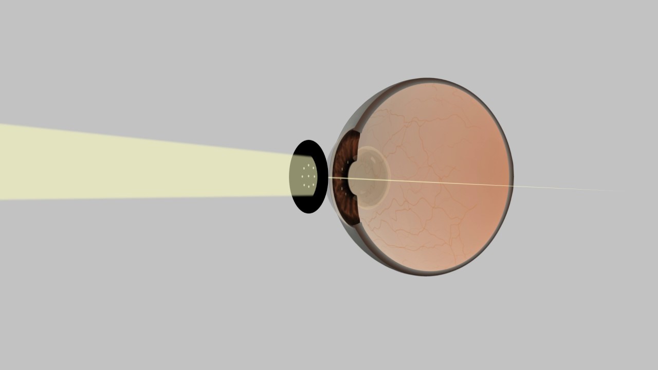 How £10 may have saved my vision – OCT scan – Techcessability